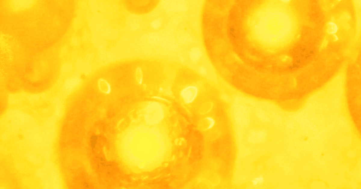 Understanding What Happens During Ovulation Understanding What Happens During Ovulation